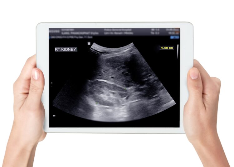 Padidėjusi blužnis (splenomegalija): simptomai, priežastys ir gydymas